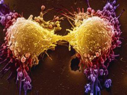 Sumário de Biologia do Câncer